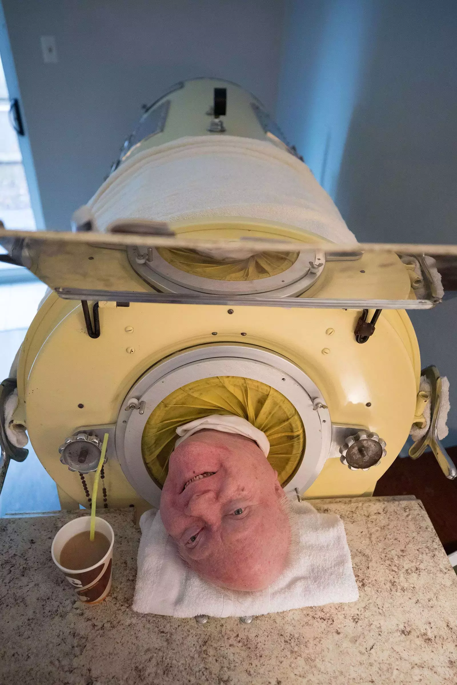 Paul Polio Who Lived In Iron Lung For 7 Decades Is No More! | Paul ...