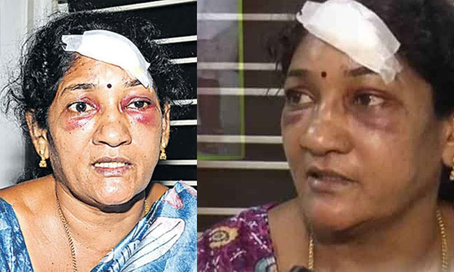 రక్తం చిందించిన మంజులా రెడ్డి.. కష్టం గుర్తించి గౌరవించిన టీడీపీ ...